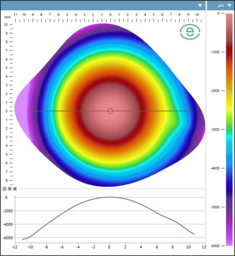 Profilometry Maps - Eaglet Eye